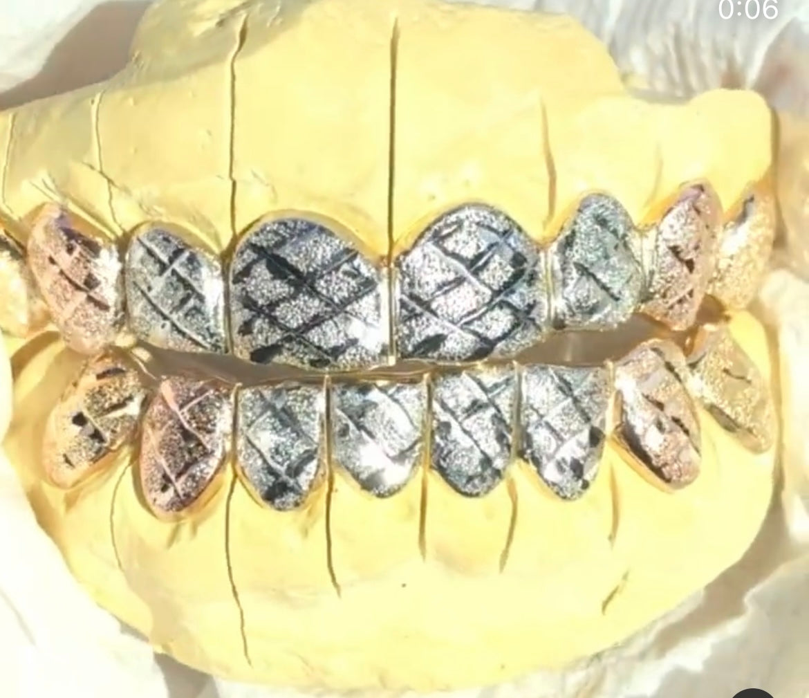 Gold Grills – Forever Diamond Design